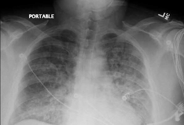 Burning Up? A Guide to Treating Heat Illness