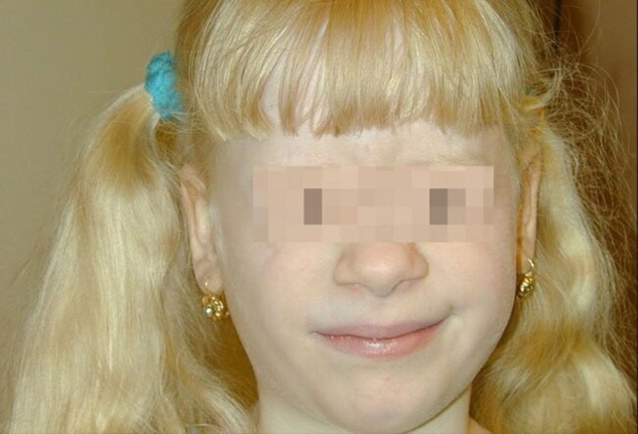 6 Common-to-Rare Infant Skin Conditions