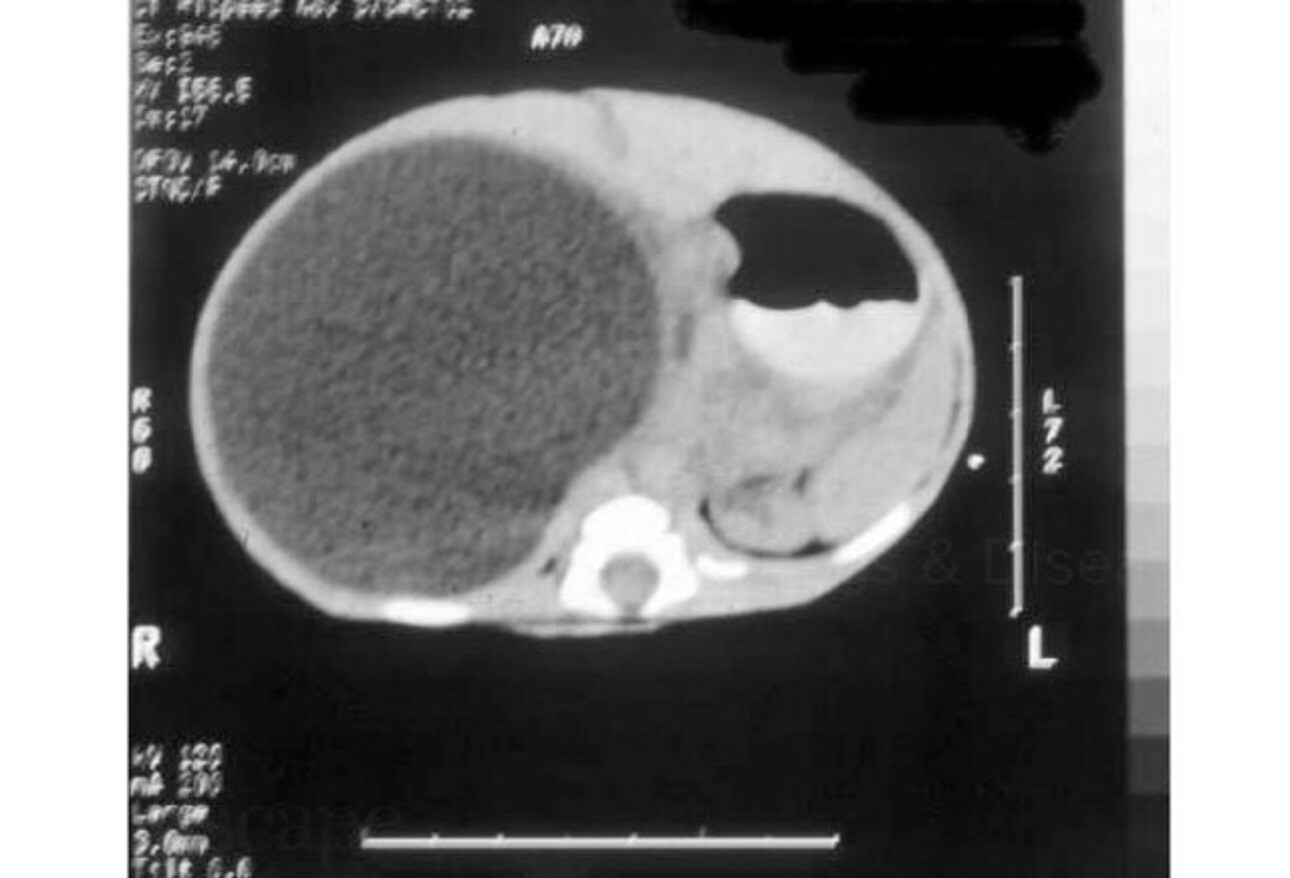 6 Common-to-Rare Infant Skin Conditions