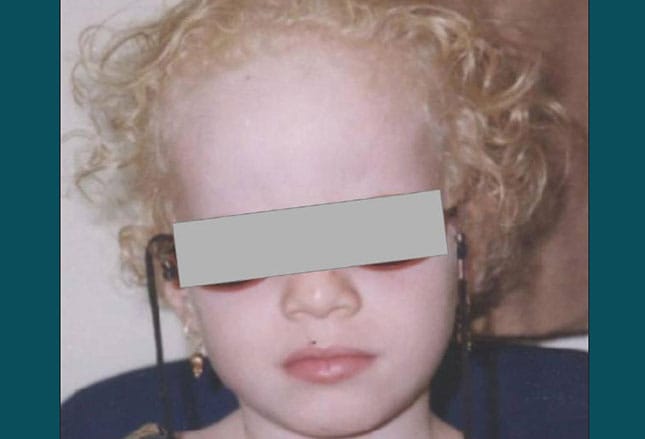 6 Common-to-Rare Infant Skin Conditions