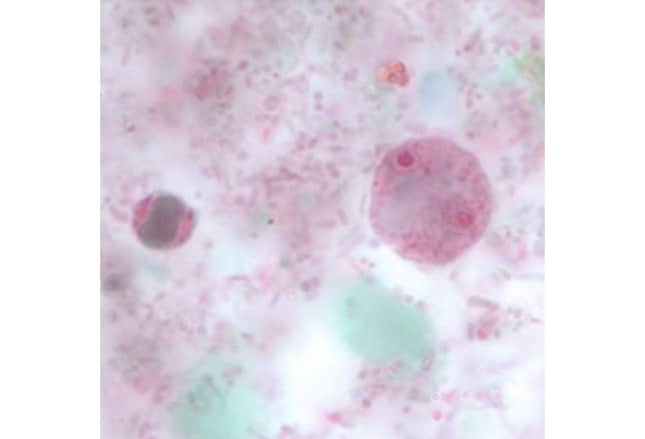 What's Eating You: 12 Common Intestinal Parasites