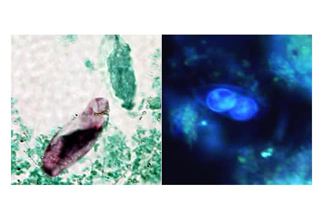 What's Eating You: 12 Common Intestinal Parasites