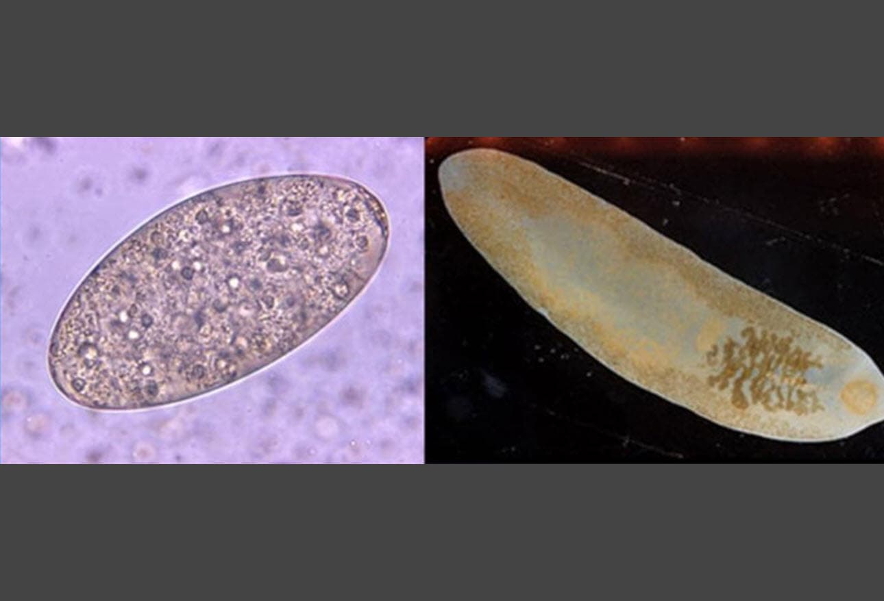 You've Got Worms! Common Intestinal Parasites