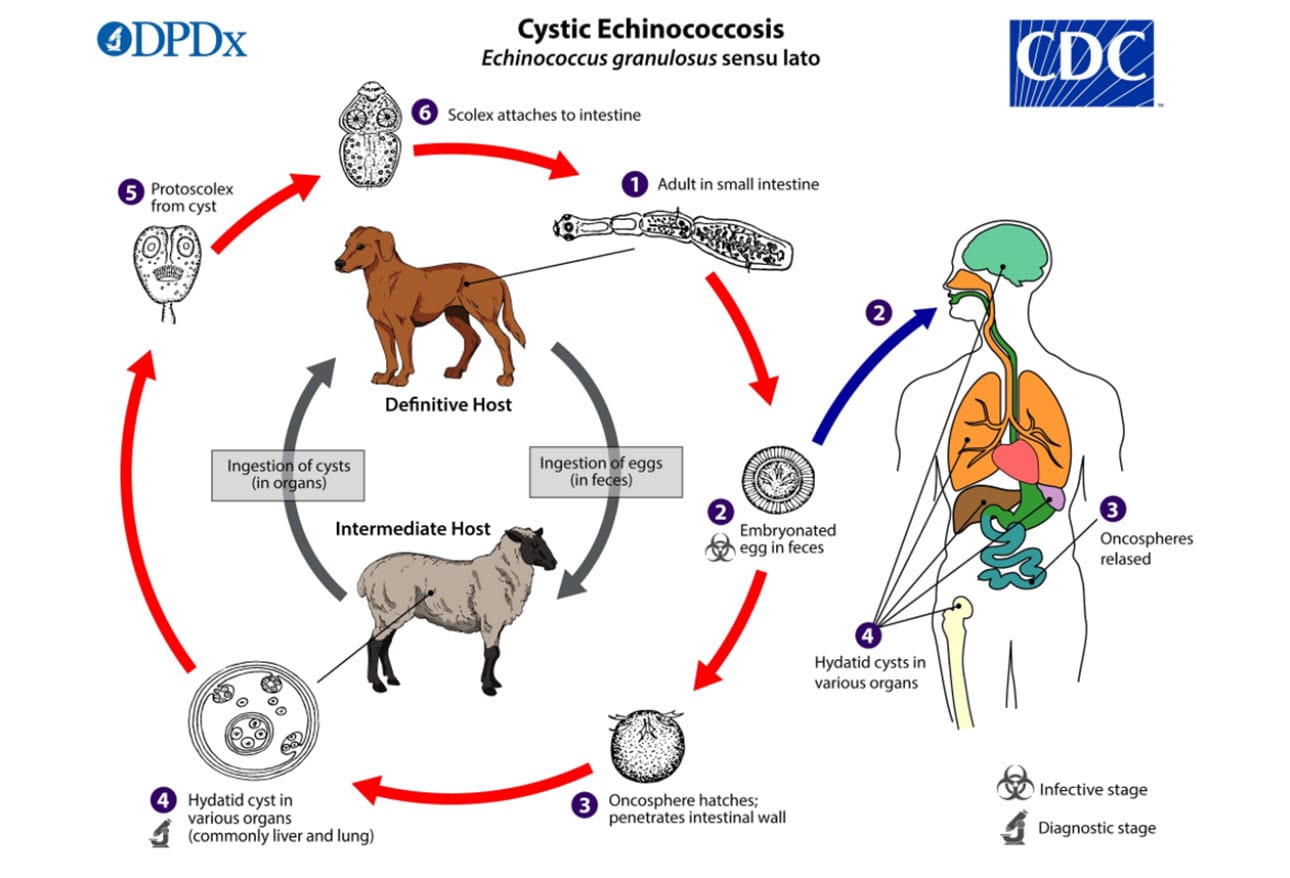 You've Got Worms! Common Intestinal Parasites