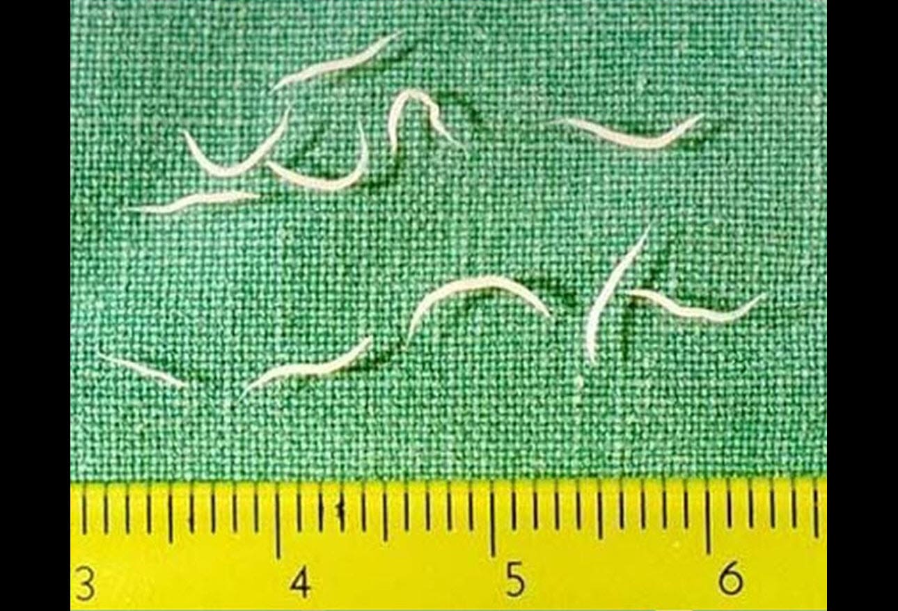 You've Got Worms! Common Intestinal Parasites