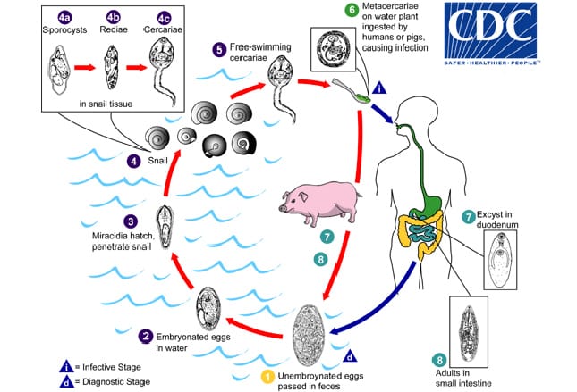 You've Got Worms! Common Intestinal Macroparasites