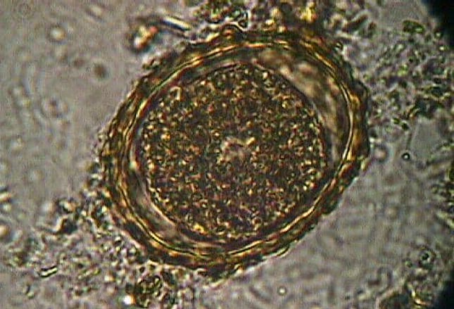 You've Got Worms! Common Intestinal Macroparasites