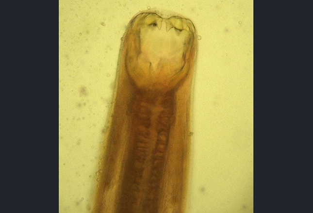 You've Got Worms! Common Intestinal Macroparasites