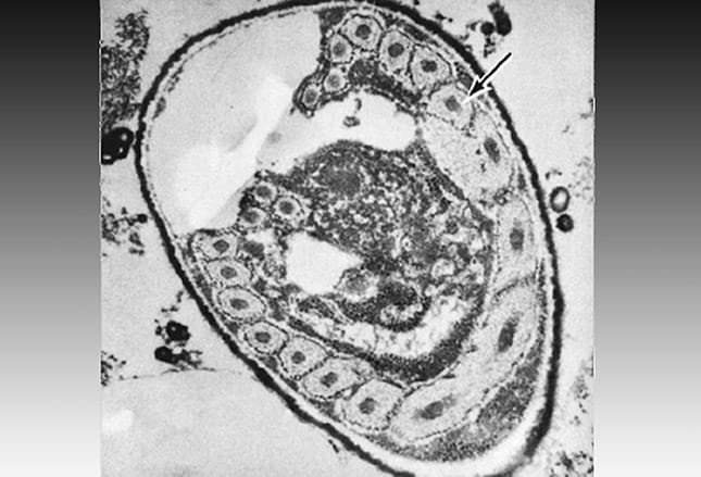 Colon Parasites