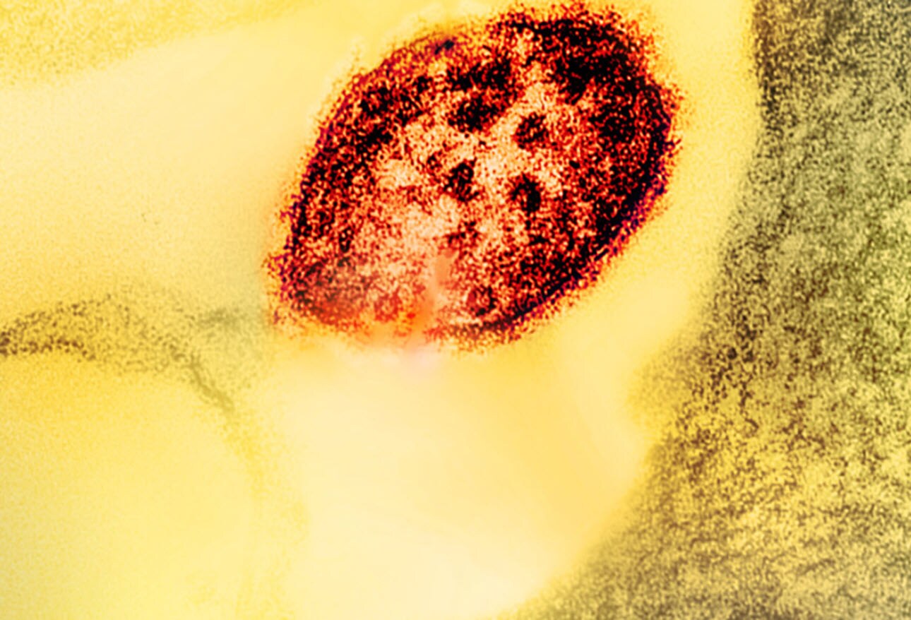 Measles: More Than Just a Rash