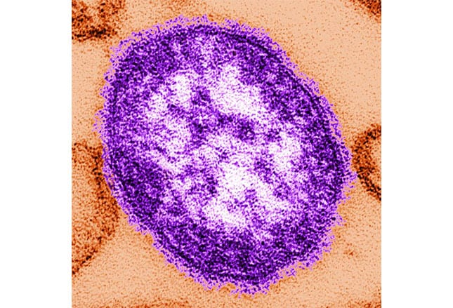 Measles: More Than a Rash