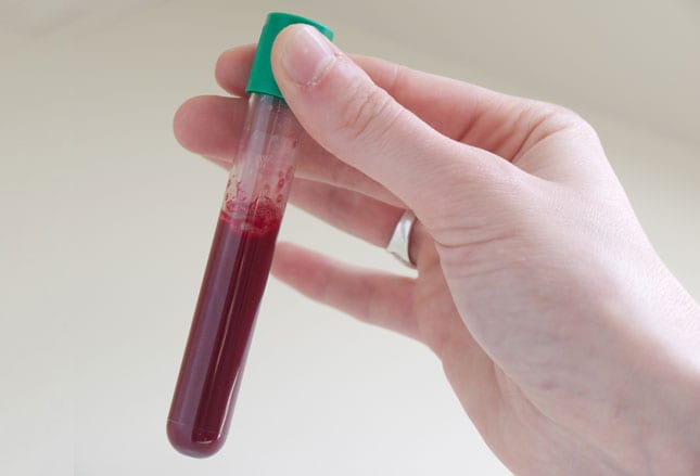 Measles: More Than a Rash