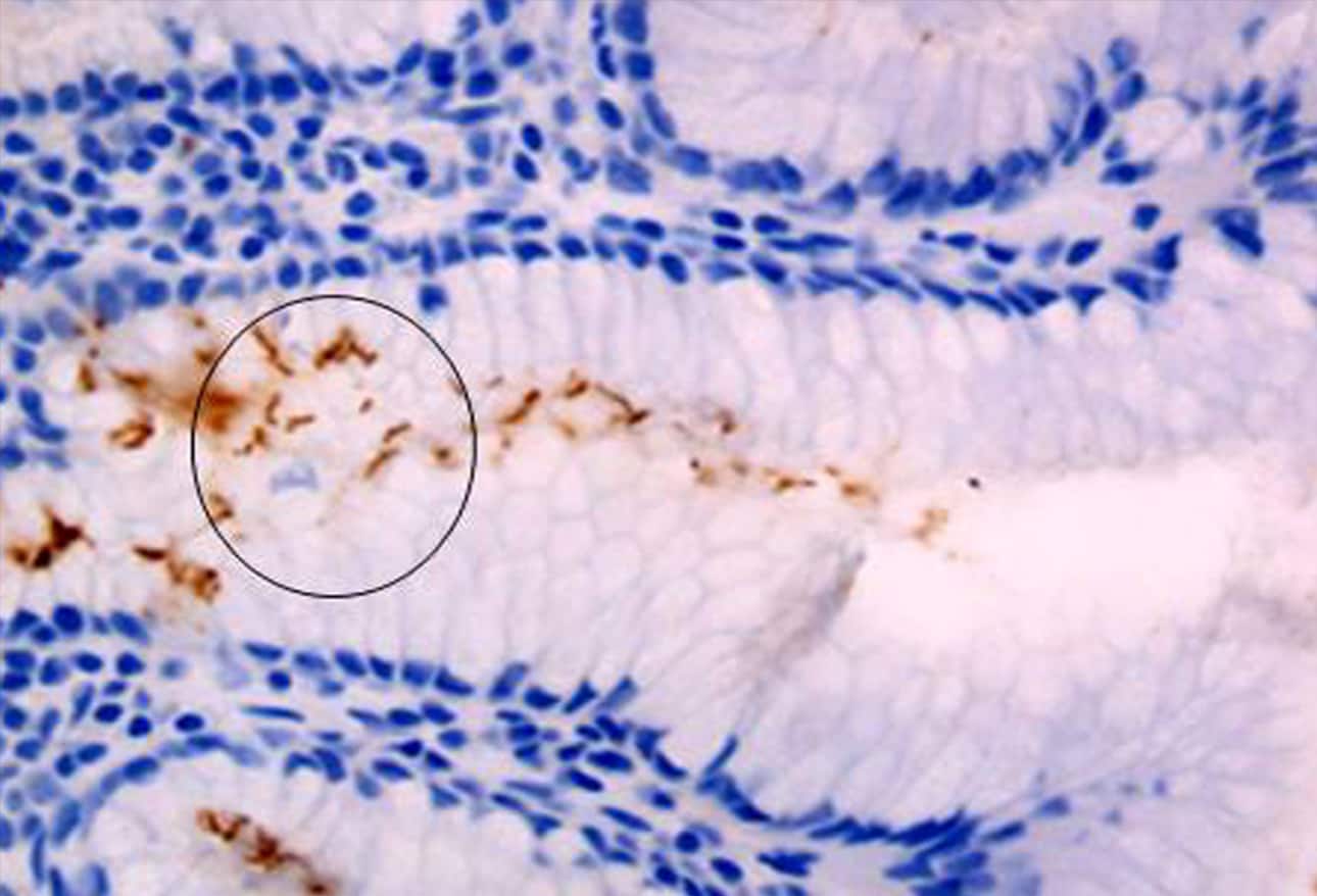Multidrug Resistant Organisms (MDROs): Growing, Spreading, and Killing