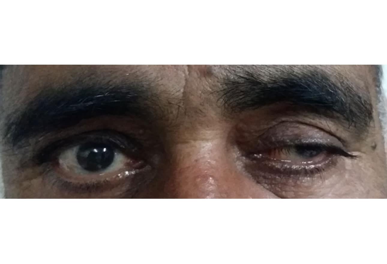 Myopathies: Muscling Your Way to the Diagnosis