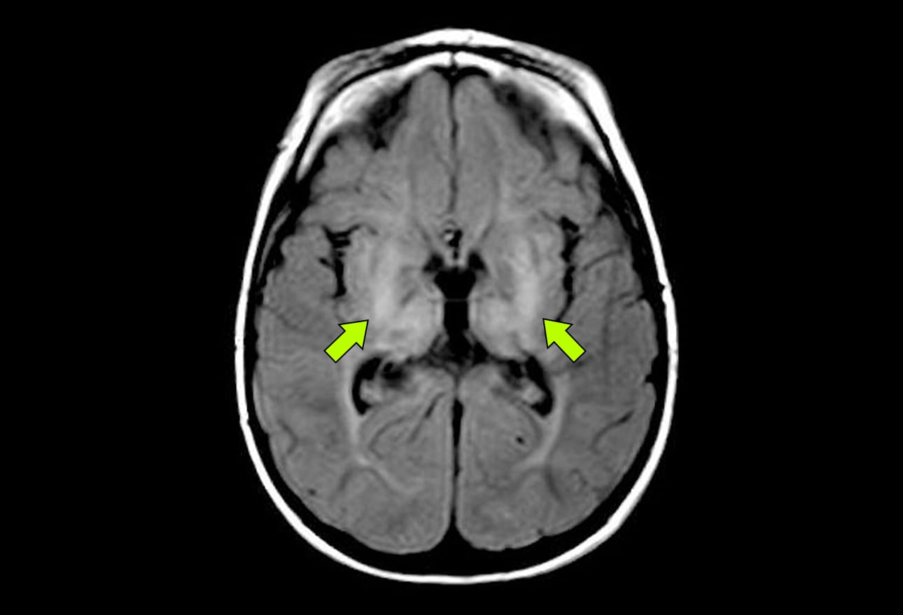 Neonatal and Infant Brain Imaging Evaluation