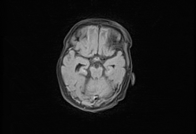 Neonatal and Infant Brain Imaging Evaluation
