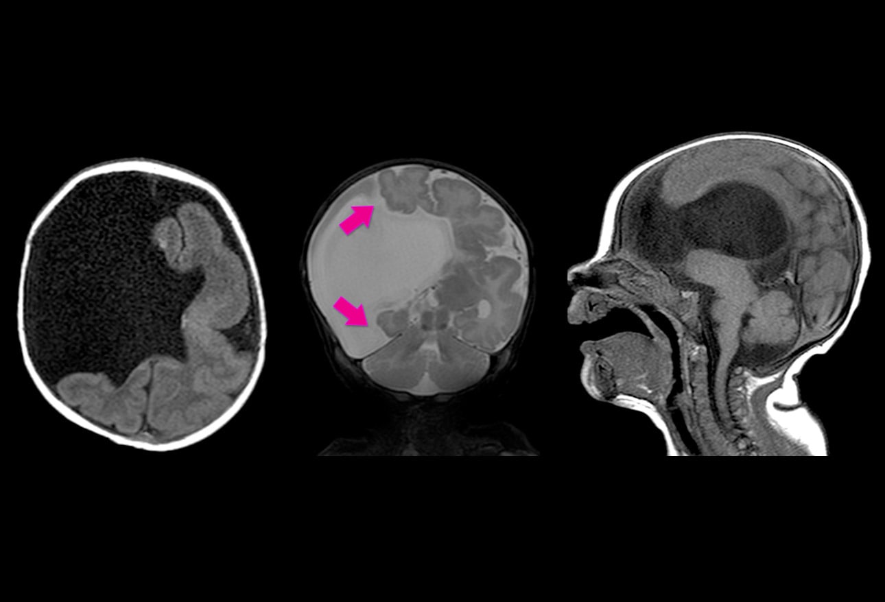Neonatal and Infant Brain Imaging Evaluation