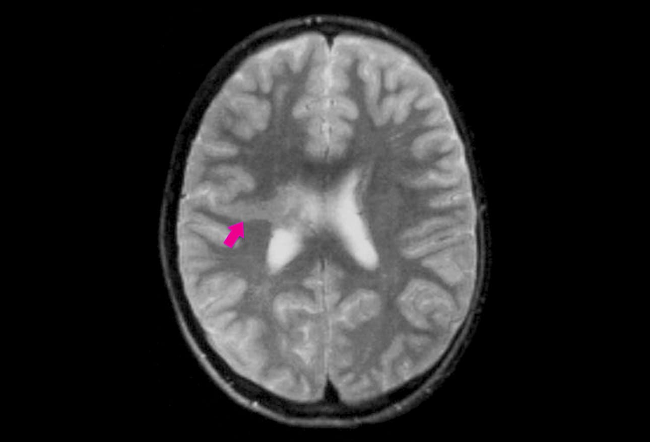 Neonatal and Infant Brain Imaging Evaluation