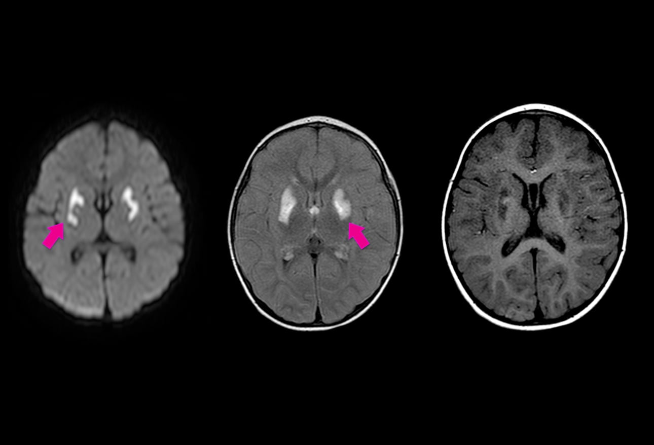 Neonatal and Infant Brain Imaging Evaluation