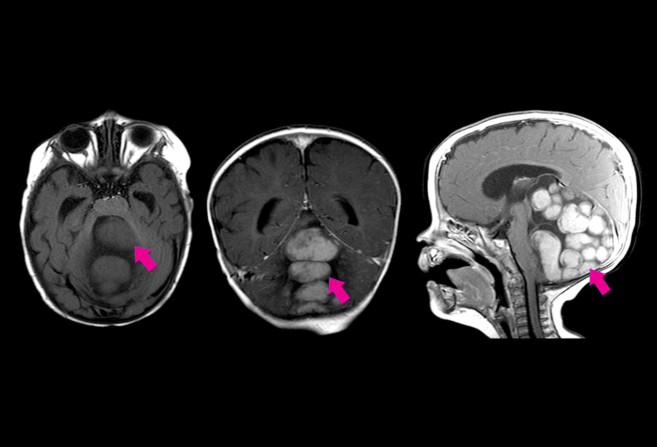 Neonatal and Infant Brain Imaging Evaluation