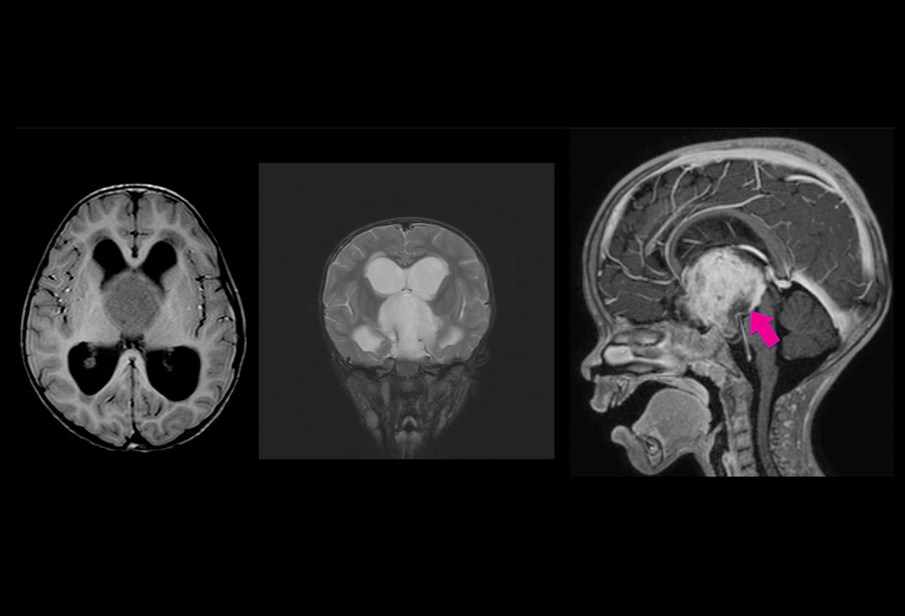 Neonatal and Infant Brain Imaging Evaluation