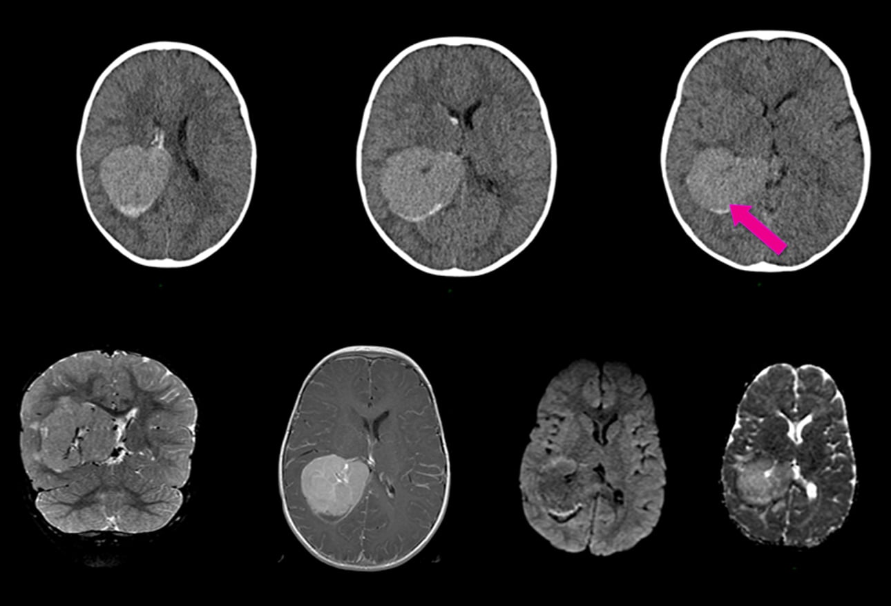 Neonatal and Infant Brain Imaging Evaluation