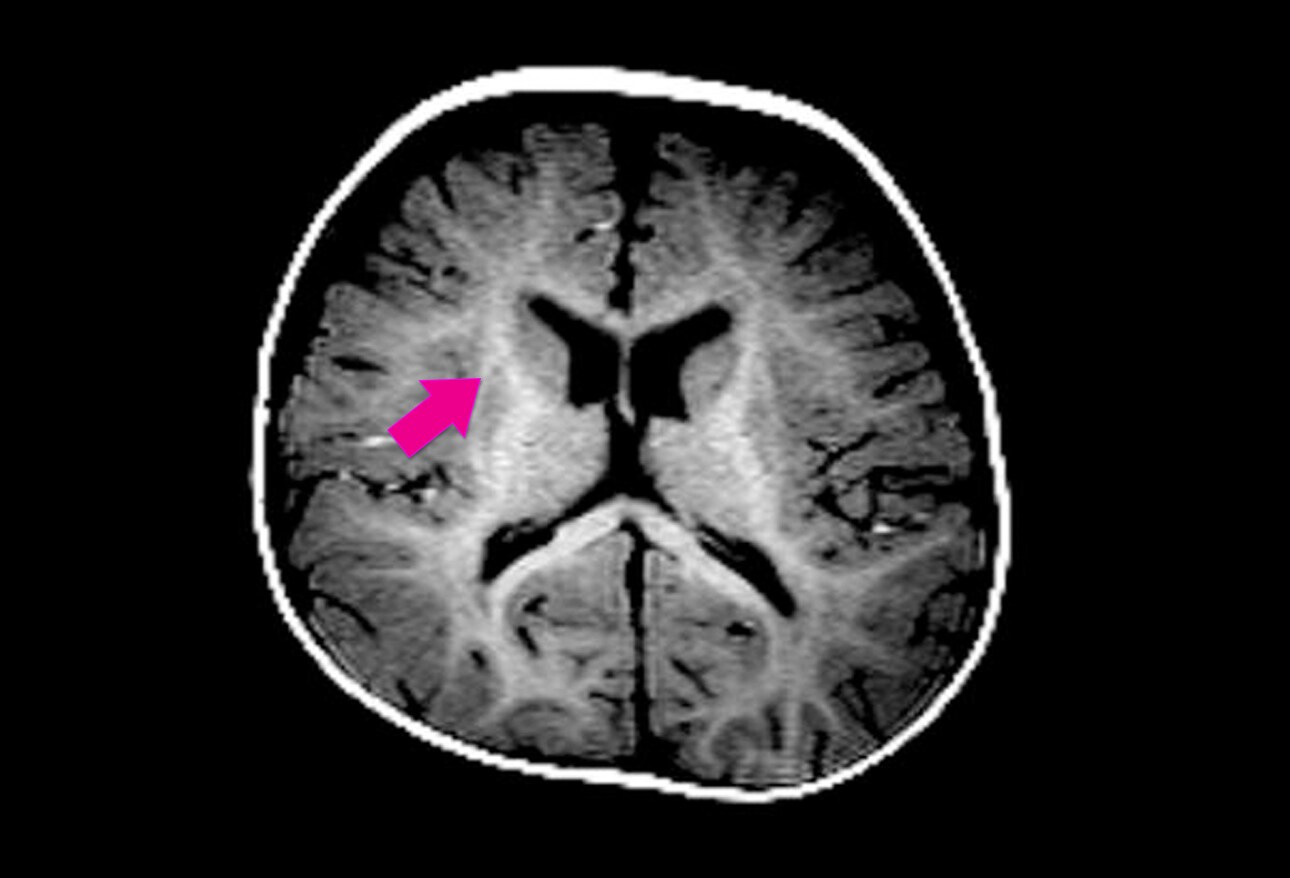 Neonatal and Infant Brain Imaging Evaluation