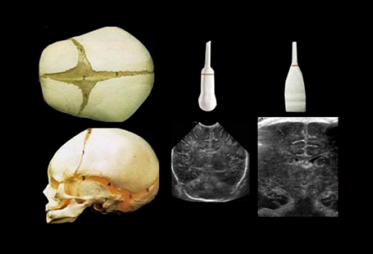 Neonatal and Infant Brain Imaging Evaluation