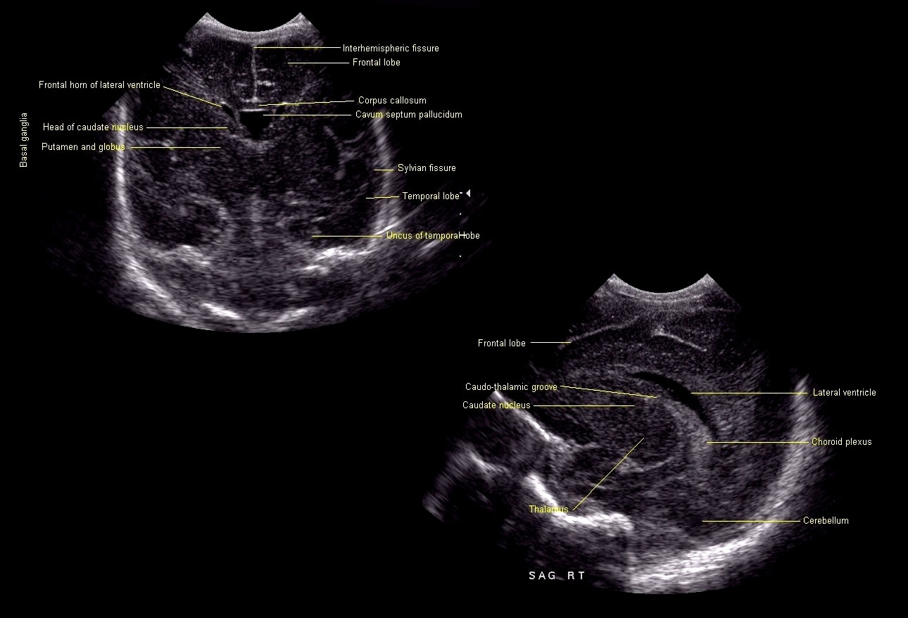 Neonatal and Infant Brain Imaging Evaluation