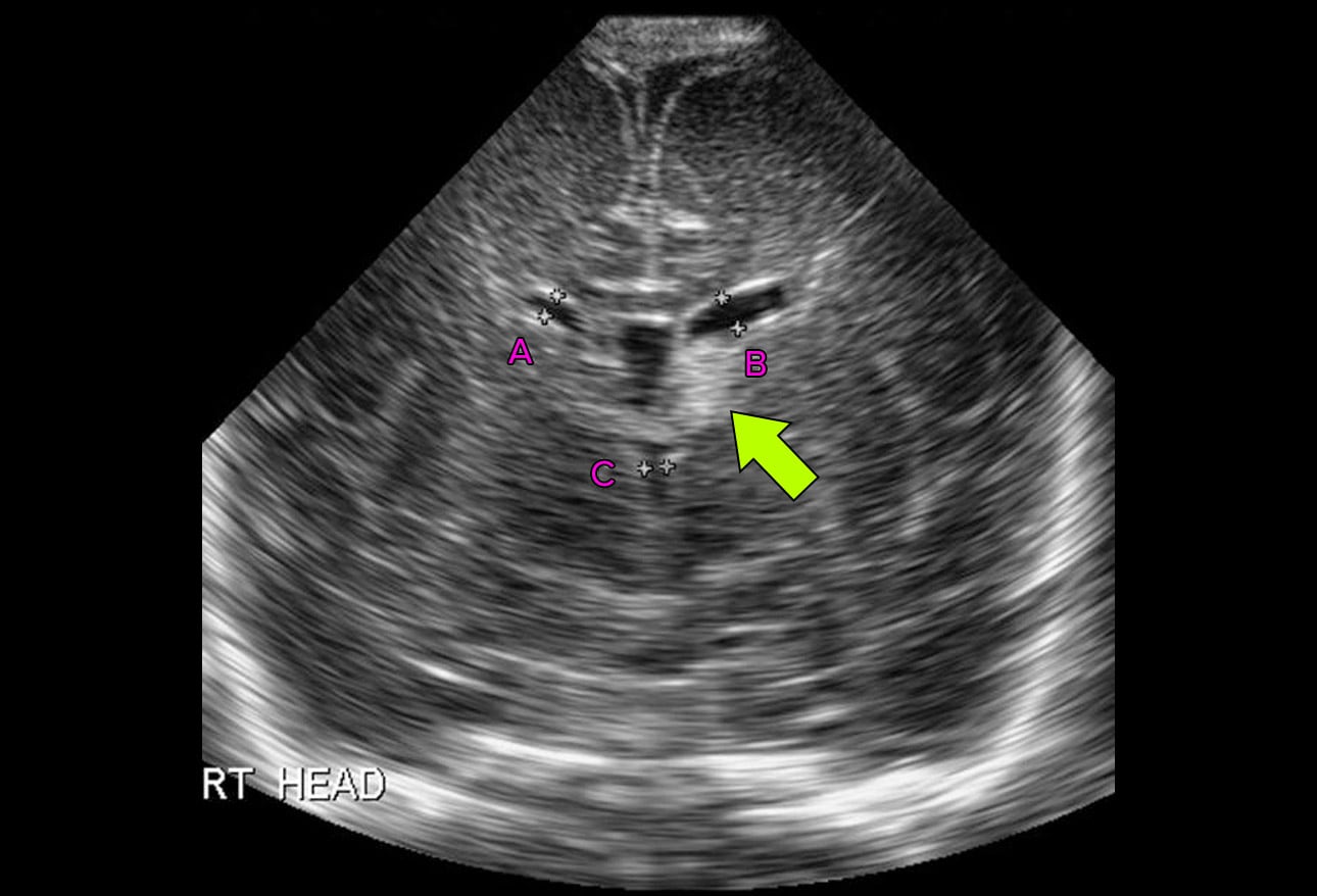 Neonatal and Infant Brain Imaging Evaluation