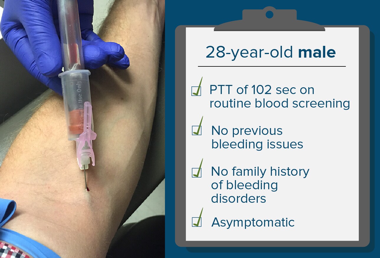 Nonhemophilia Bleeding Disorders: The Coagulation Factor Factor