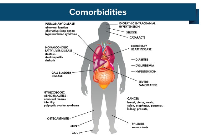 Obesity: How to Diagnose and Treat an Epidemic