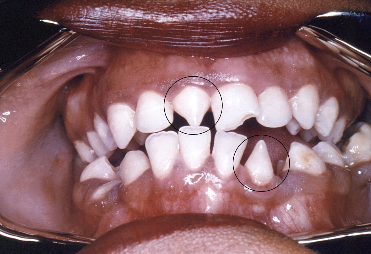 Clues in the Oral Cavity: Are You Missing the Diagnosis?