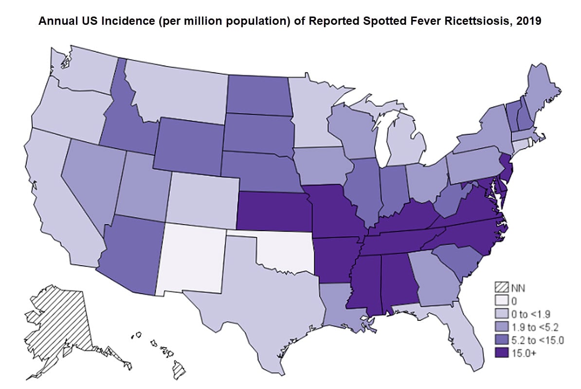 You Give Me Fever: Four "Other" Tickborne Illnesses