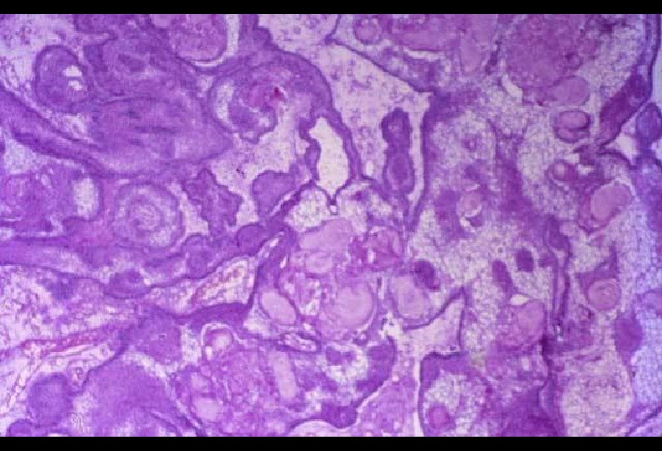 Pediatric Brain Tumors: Imaging Matters