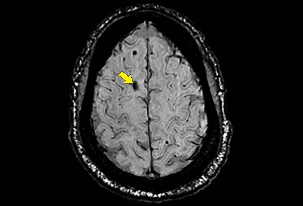 Pediatric Concussion and Other Traumatic Brain Injuries