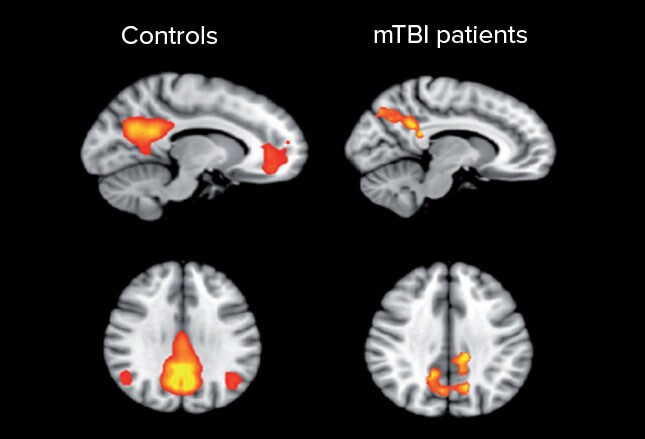 Pediatric Concussion and Other Traumatic Brain Injuries
