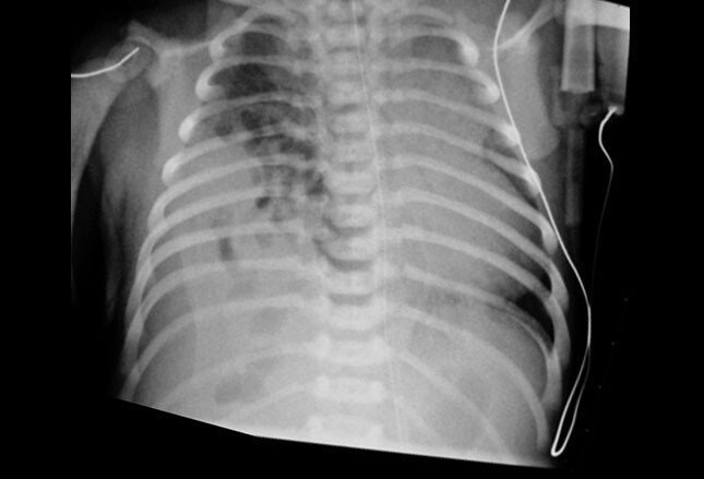 16 Can’t-Miss Findings on Pediatric Imaging Studies