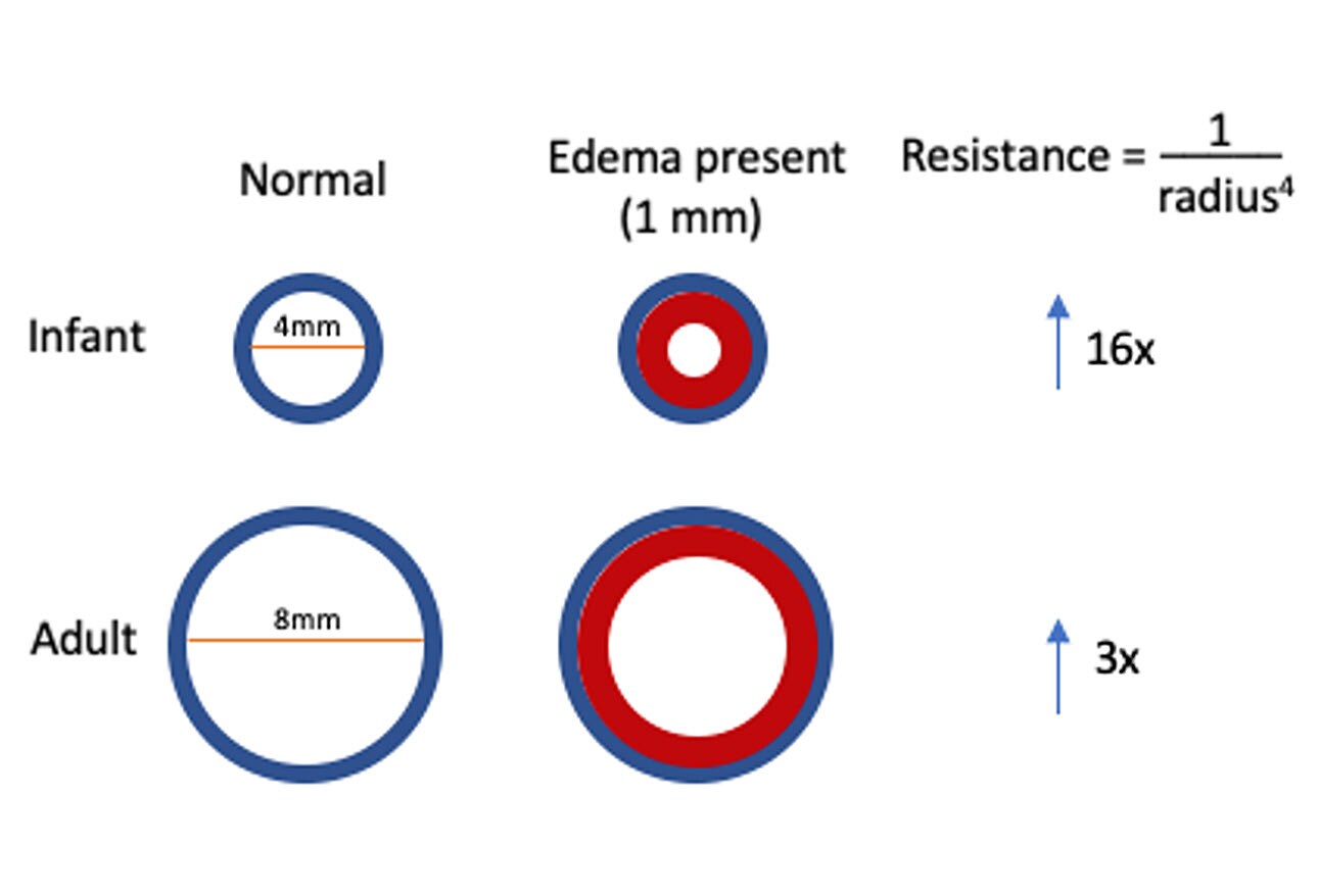 When Distress is Failure: Pediatric Respiratory Illness
