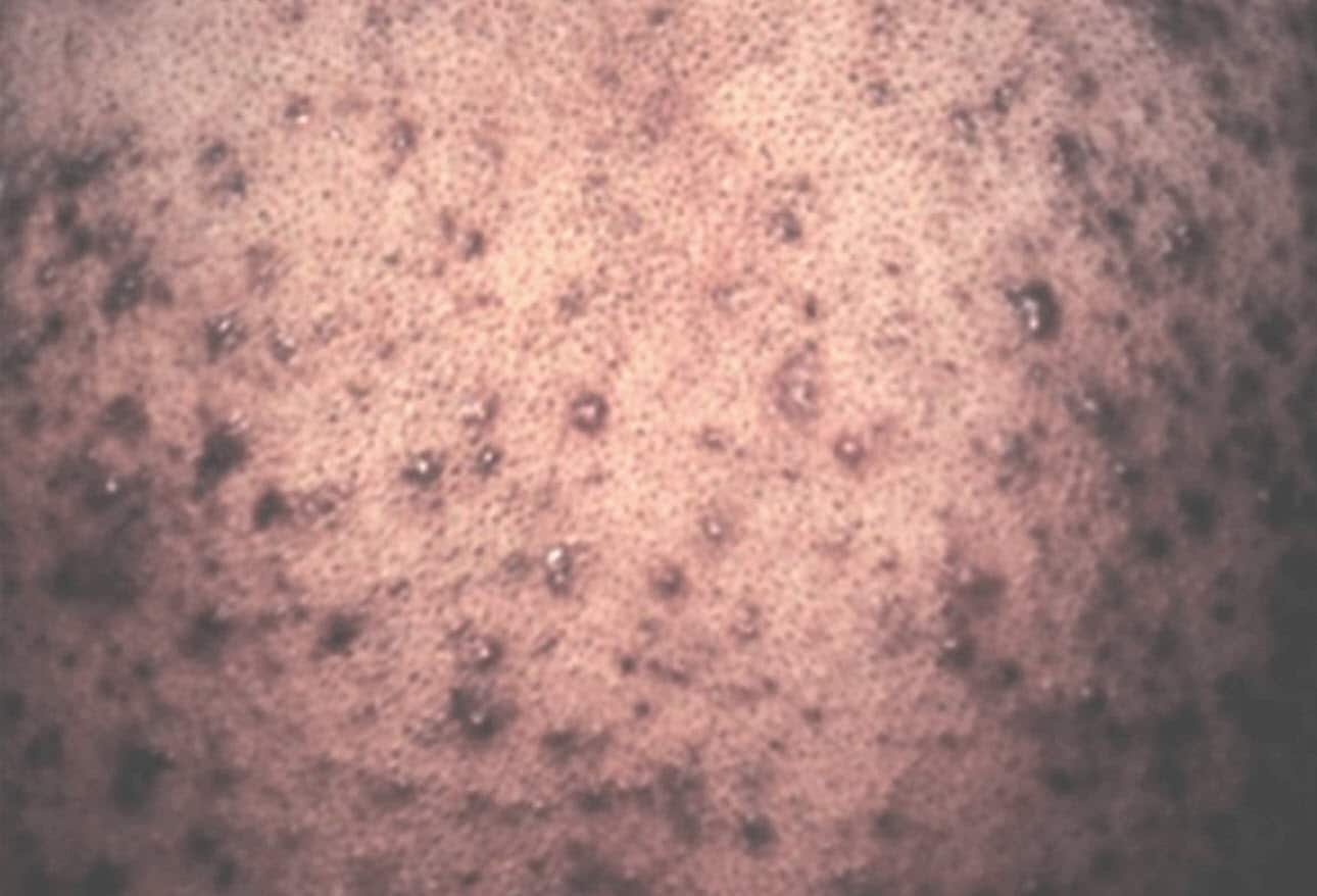 Poisoning Clues on the Skin: 8 Cases