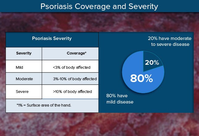 Psoriasis: Manifestations, Management, and Mimics