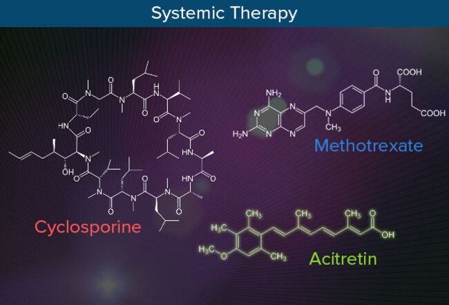 #Psoriasis: Manifestations, Management Options, and Mimics ...