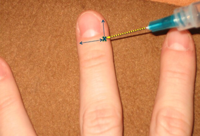 Best Practices: Regional Blocks