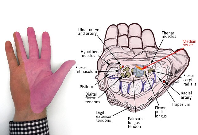 Best Practices: Regional Blocks
