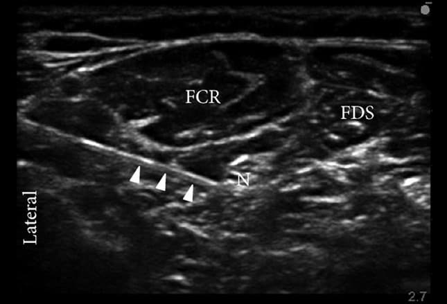 Best Practices: Regional Blocks