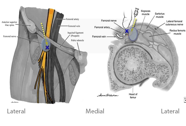 Best Practices: Regional Blocks