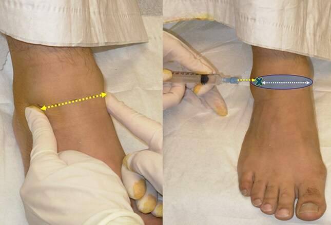 Best Practices: Regional Blocks