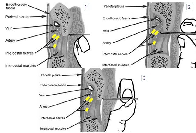 Best Practices: Regional Blocks
