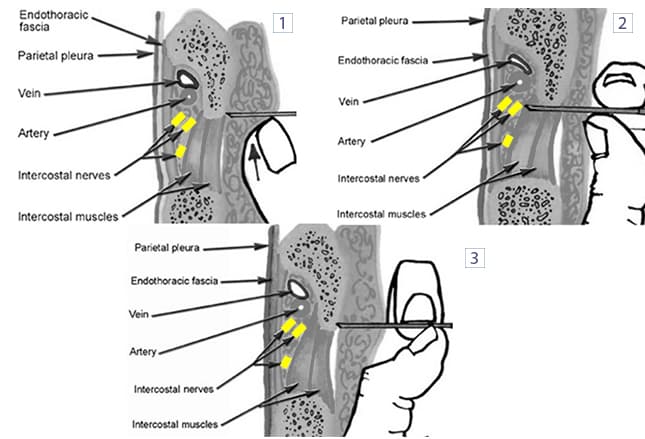Best Practices: Regional Blocks