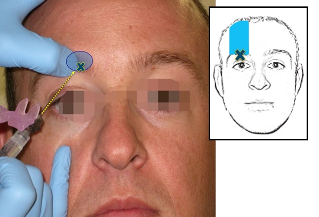 Best Practices: Regional Blocks